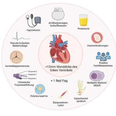 Die 2023 ESC-Leitlinie für Kardiomyopathien: Praxistipps